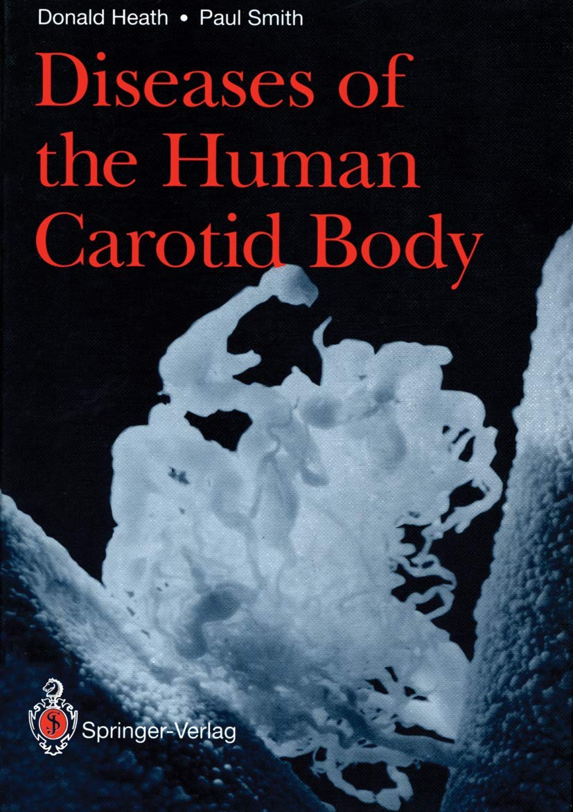 Diseases of the Human Carotid Body : Heath, Donald, Smith, Paul: Amazon ...