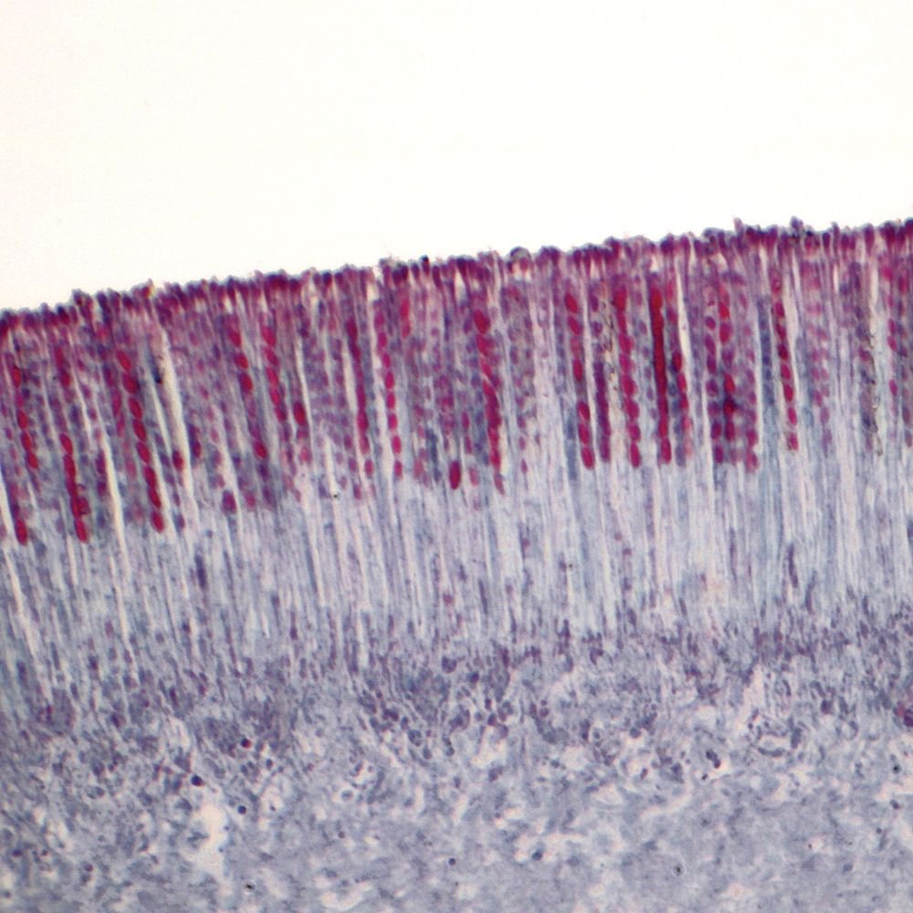 Peziza Under Microscope Labeled