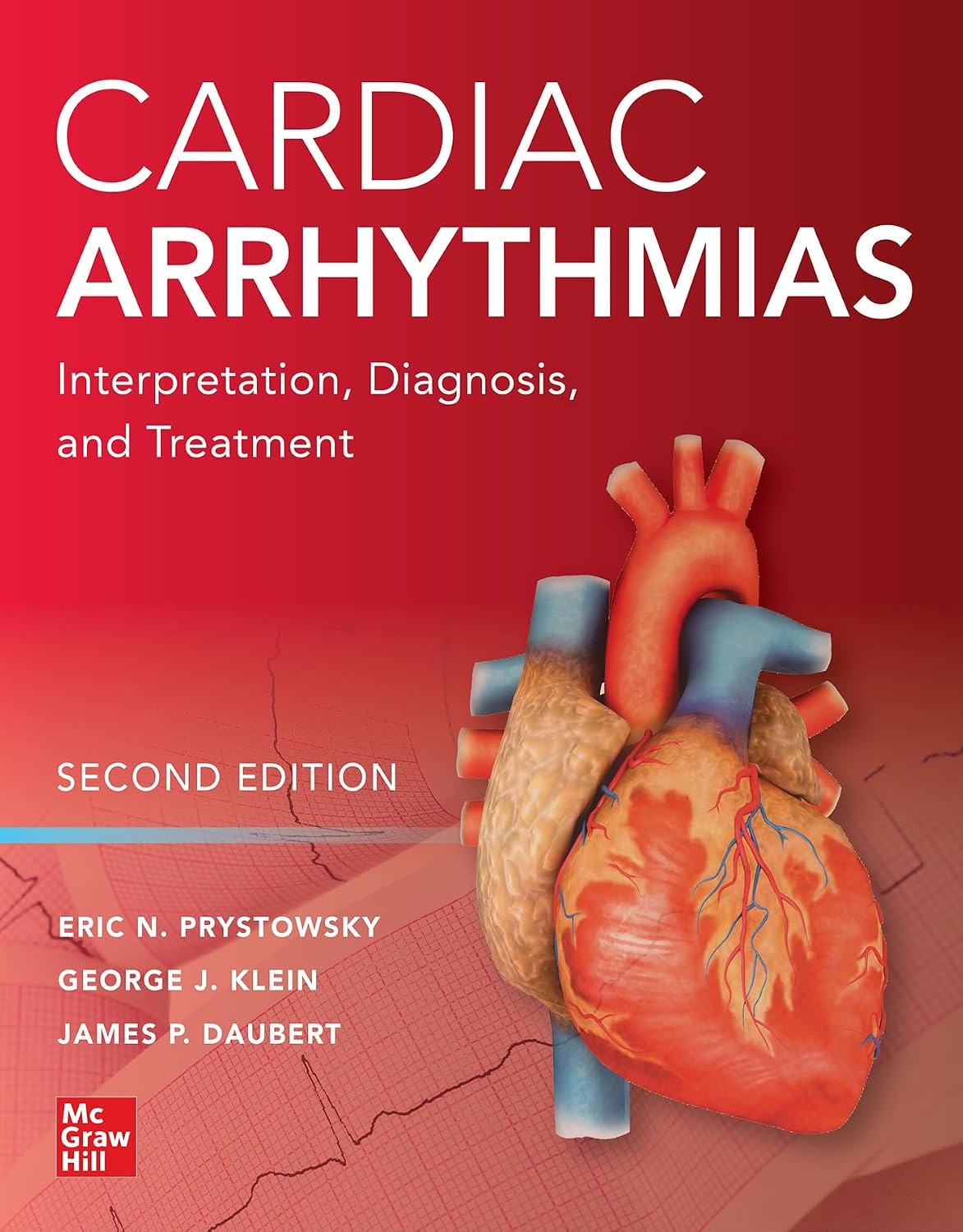 Buy Cardiac Arrhythmias: Interpretation, Diagnosis, and Treatment ...