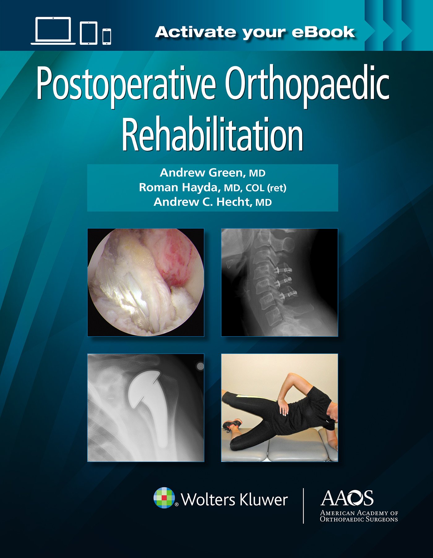 Postoperative Orthopaedic Rehabilitation: Print + Ebook (AAOS ...