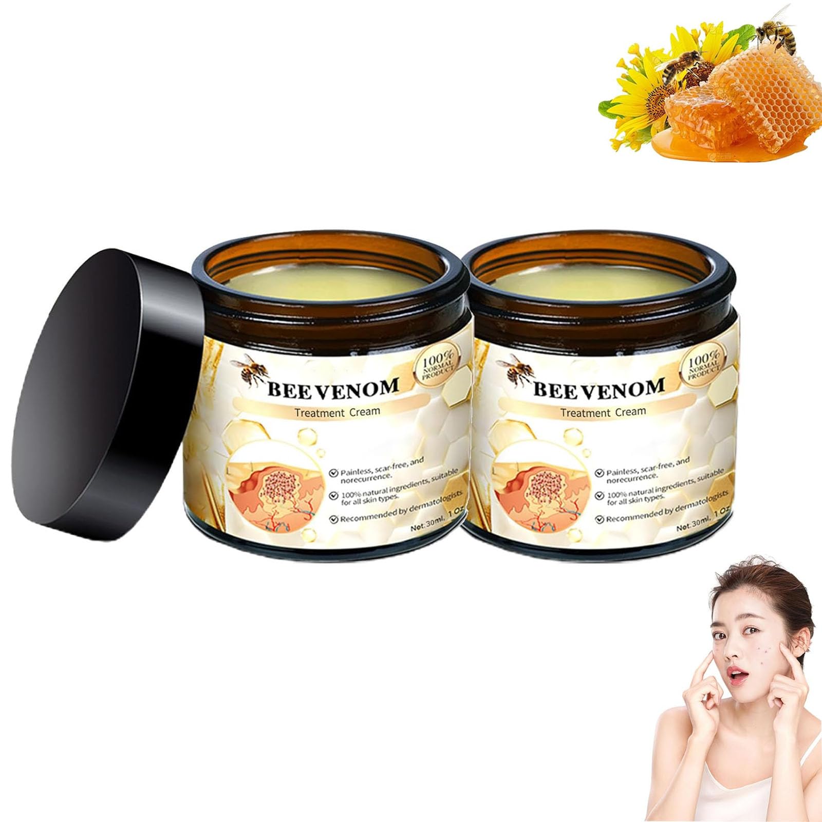 Bee Venom Treatment Cream, New Professional Bee Venom Repair Cream,Bee ...