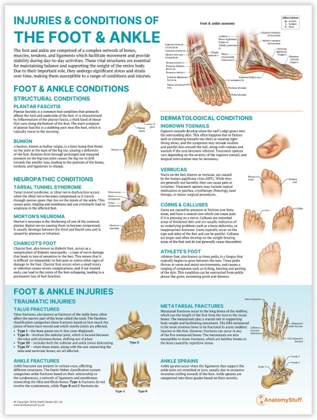 Anatomy Stuff Injuries and Conditions of the Foot and Ankle Poster ...