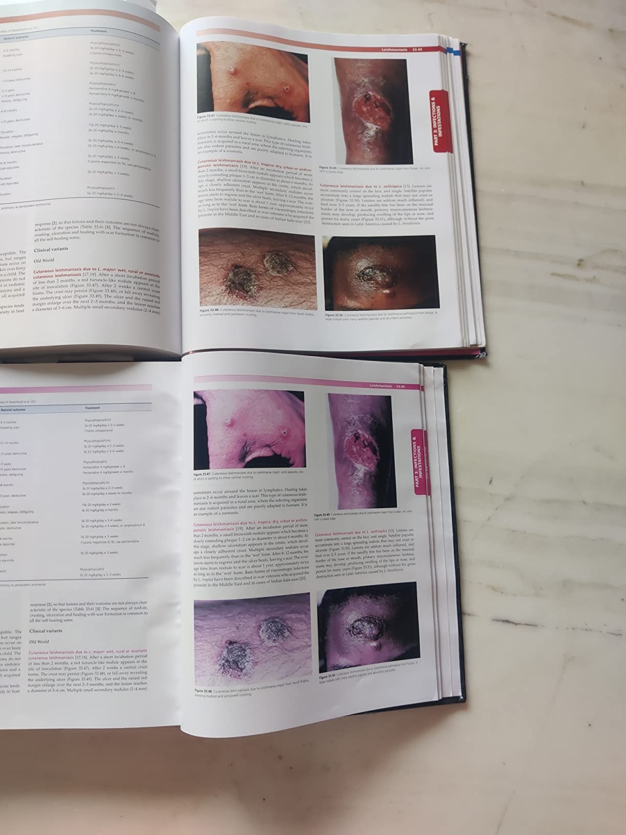 Buy Rook's Textbook of Dermatology - Ninth edition (Set of 4 Volumes ...