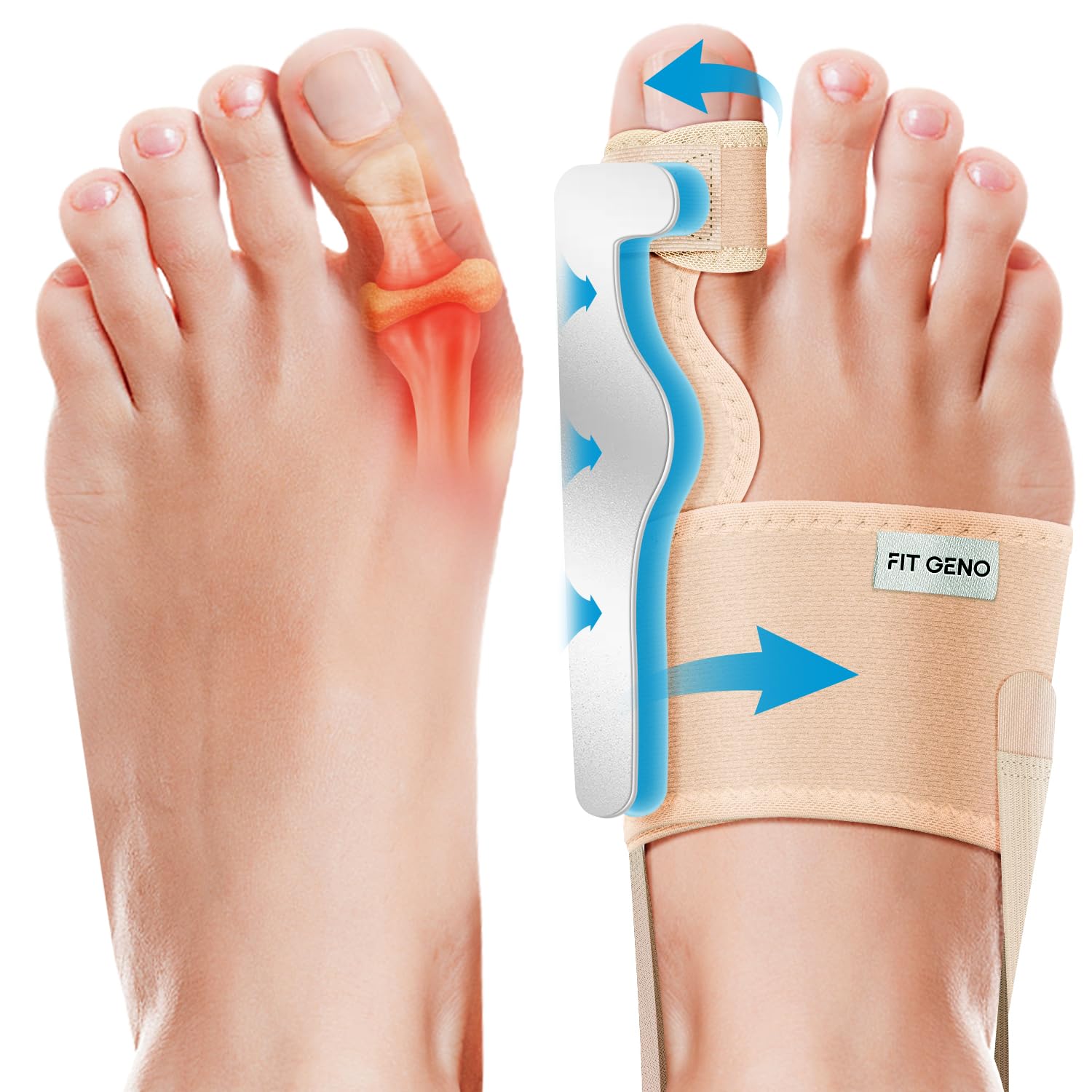 Amazon.com: Fit Geno Bunion Corrector, Adjuatable & Breathable Bunion ...