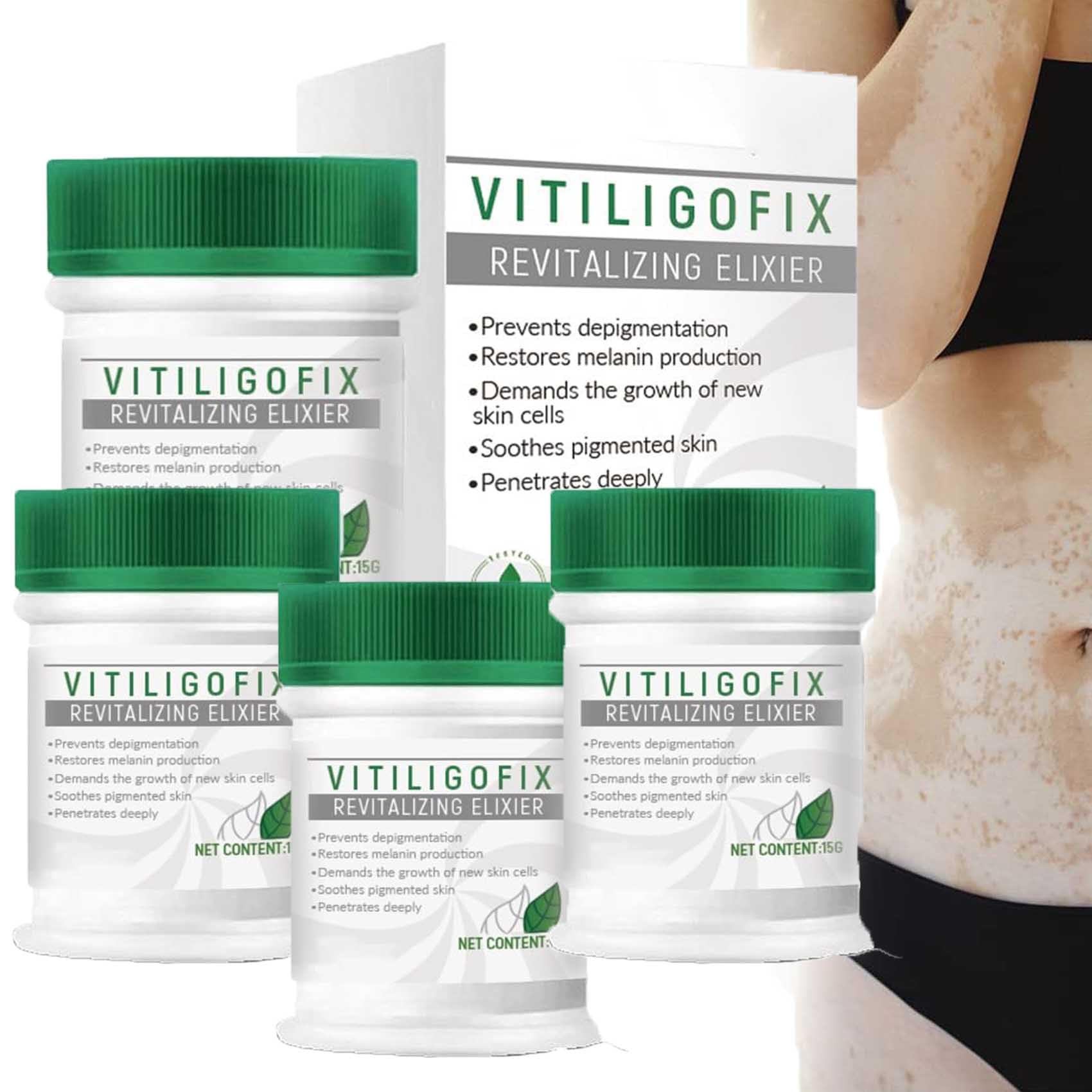 Vitiligo Fix Revitalize Elixir, 2023 New Vitiligo Treatment Cream ...