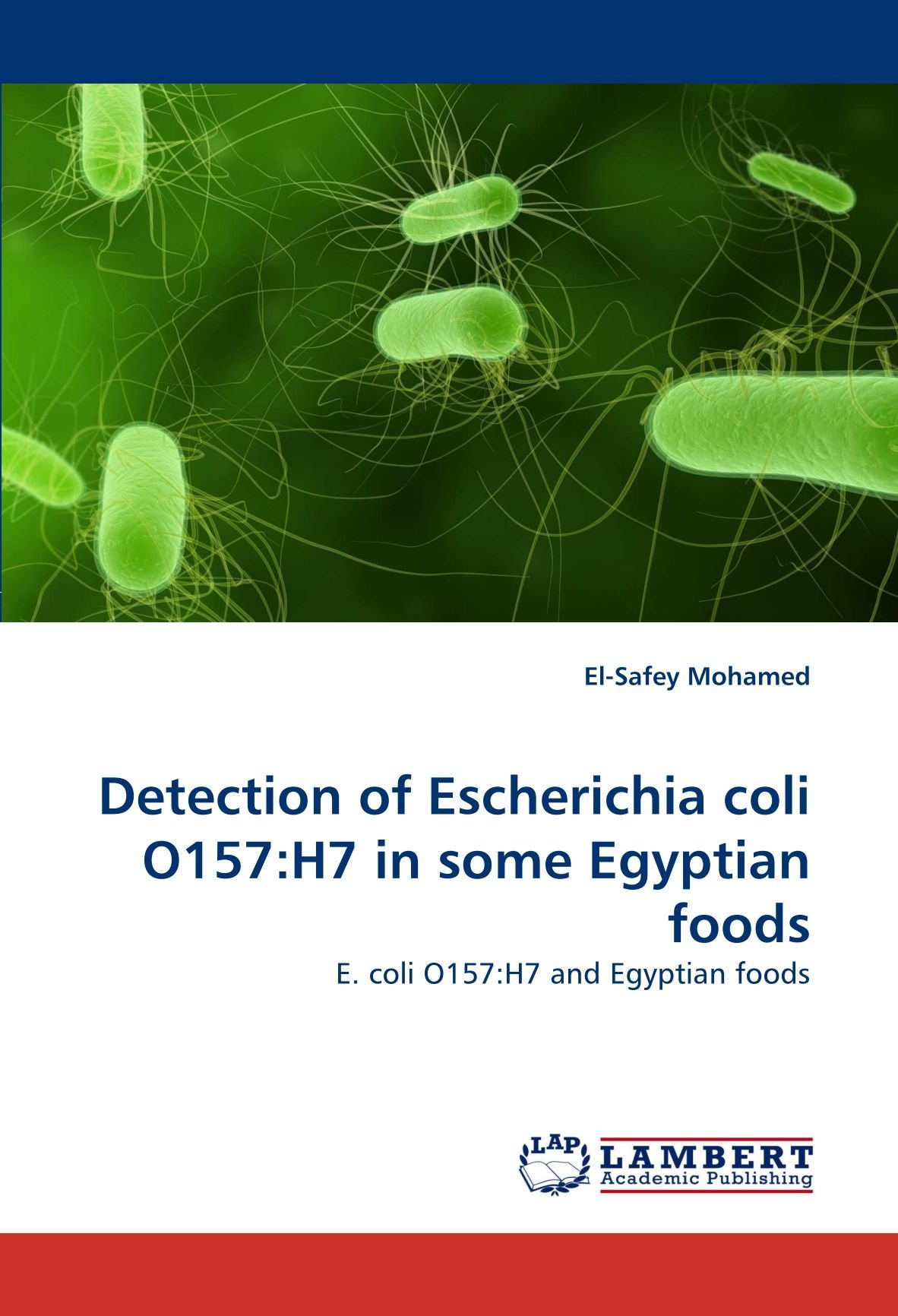 Buy Detection of Escherichia coli O157:H7 in some Egyptian foods: E. coli O157:H7 and Egyptian ...