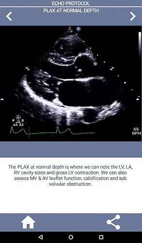 LEARN THE FULL TTE ECHO ULTRASOUND PROTOCOL DEMO - App on Amazon Appstore