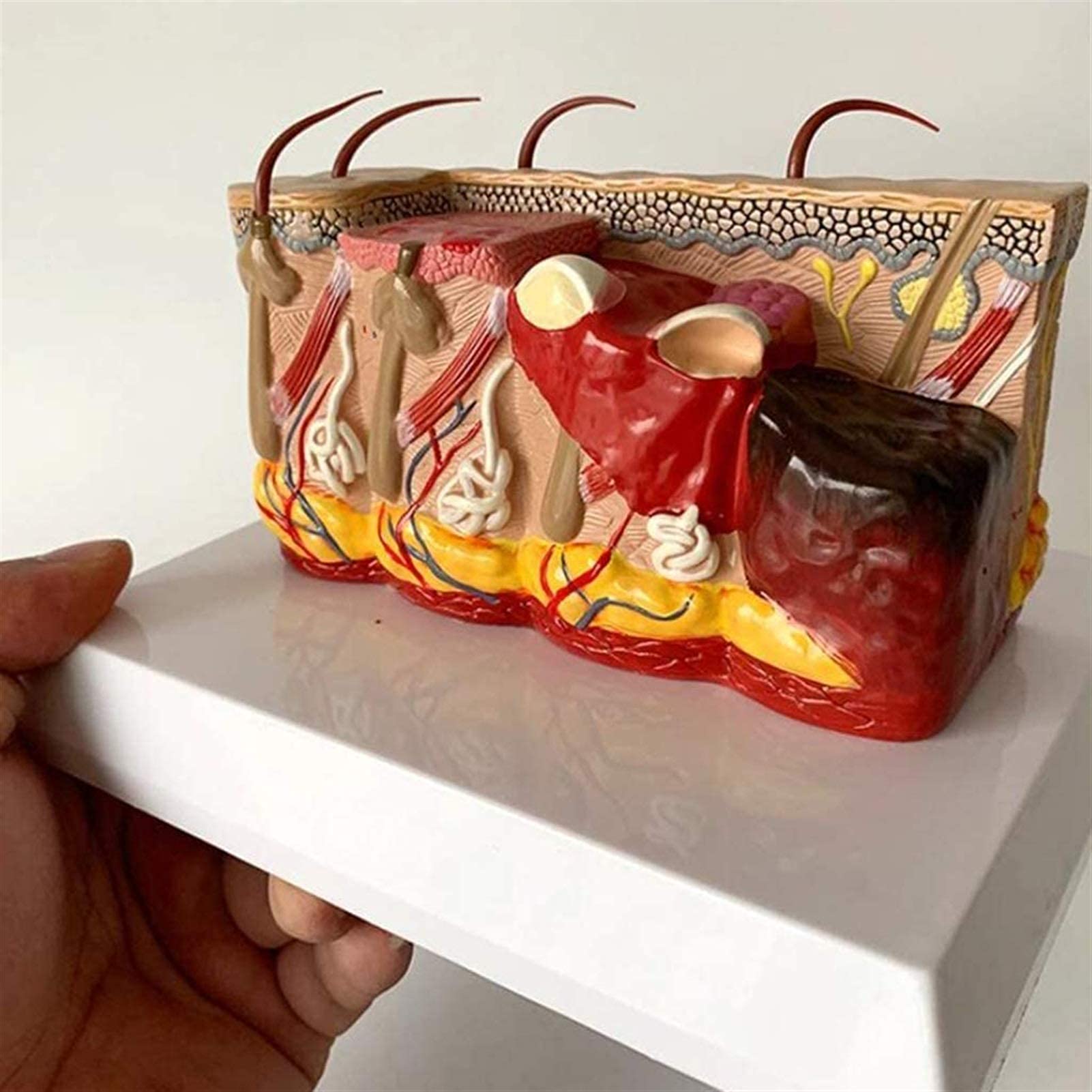 Buy Anatomy Model, Skin Burn Anatomical Model Pathological Skin Disease ...