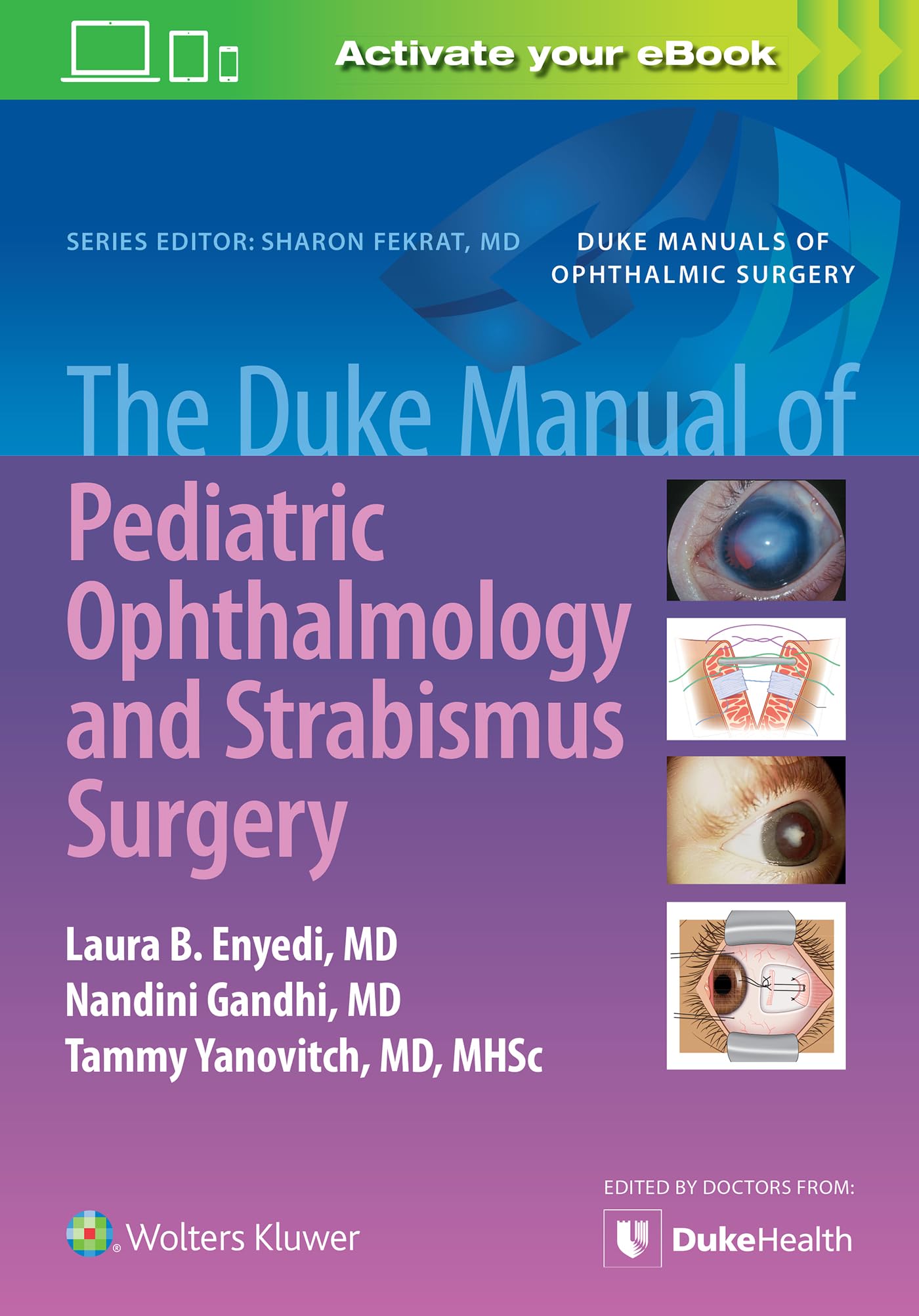 The Duke Manual of Pediatric Ophthalmology and Strabismus Surgery ...