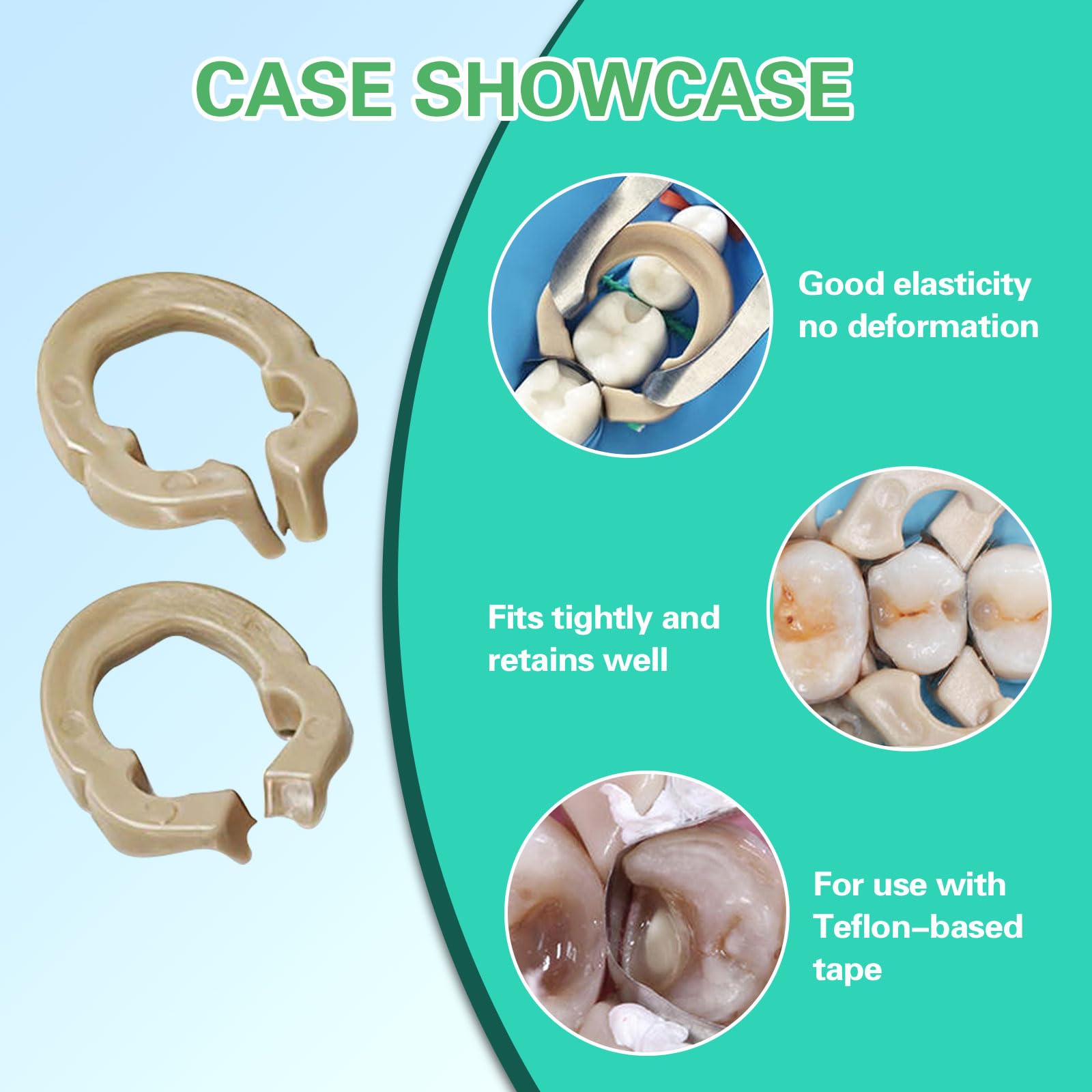 Snapklik.com : Dental Sectional Matrix System Kit, Dental Sectional ...