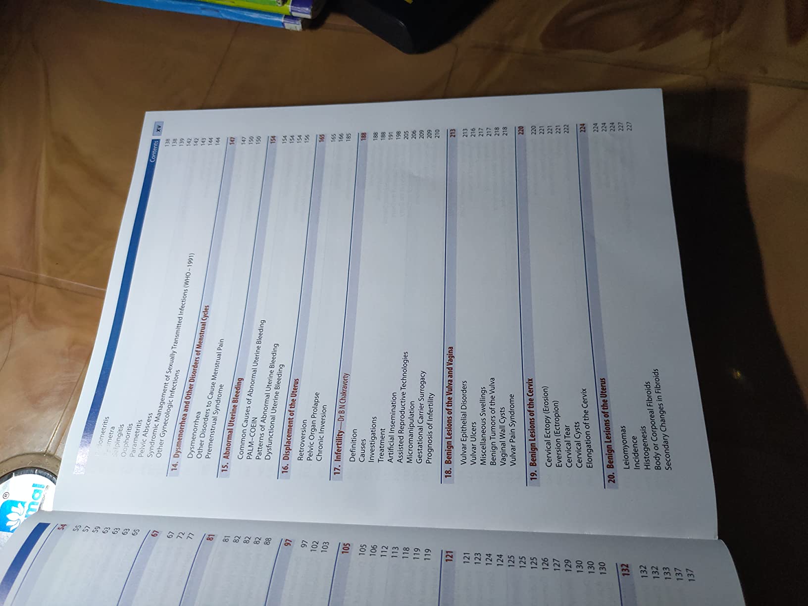 Buy DC Dutta's Textbook of Gynecology Book Online at Low Prices in ...