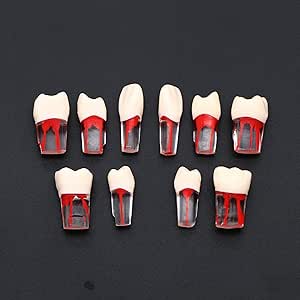 Amazon.com: Endo Dental Endo Endo Tooth Model Cavity Pulp RCT Training ...