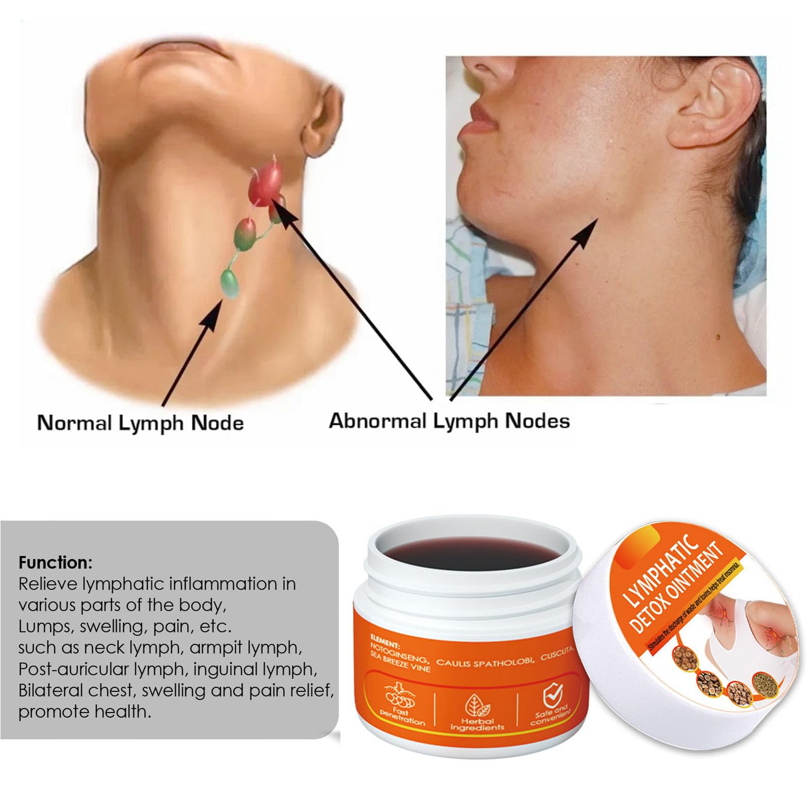 Posterior Auricular Lymph Node Lump 4474