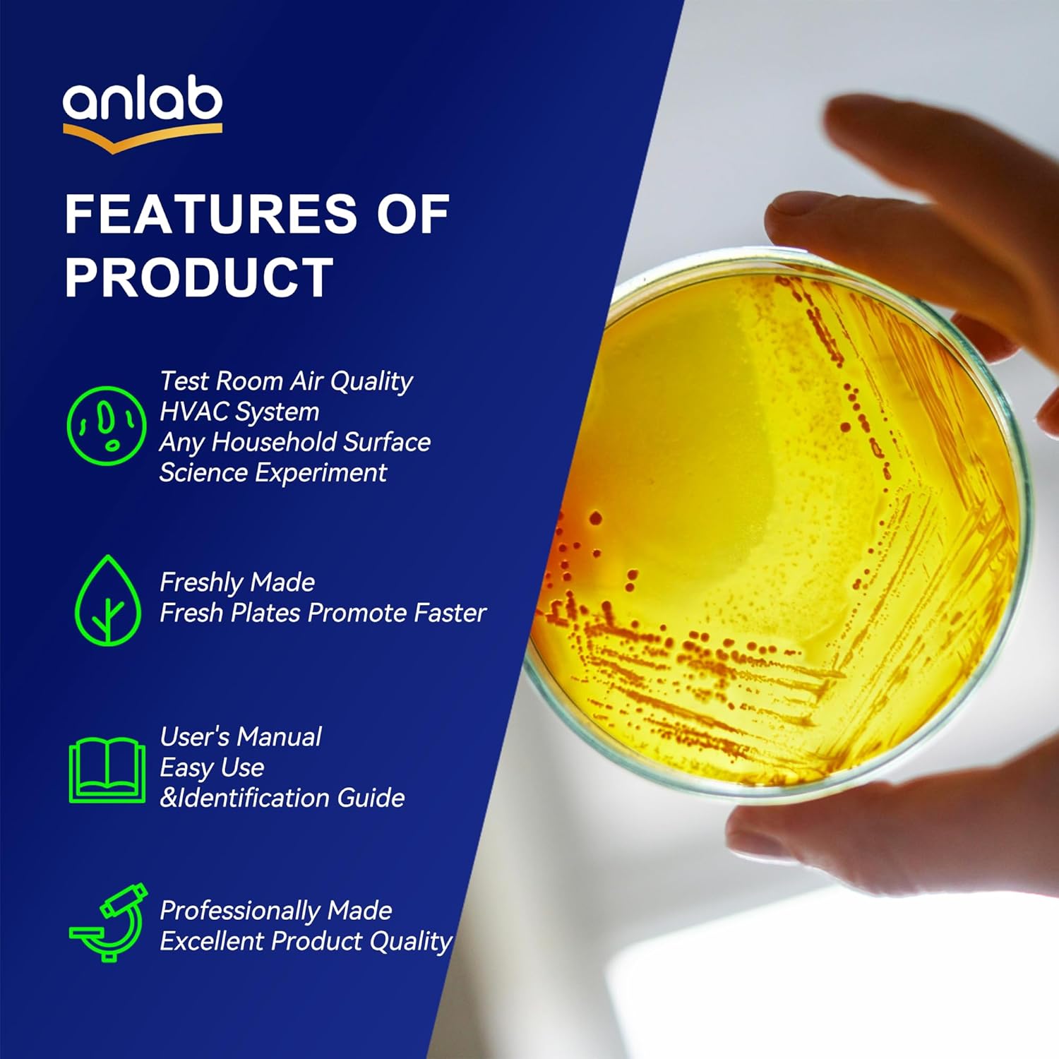 anlab™ Nutrient Agar Petri Dishes Science Project Philippines | Ubuy