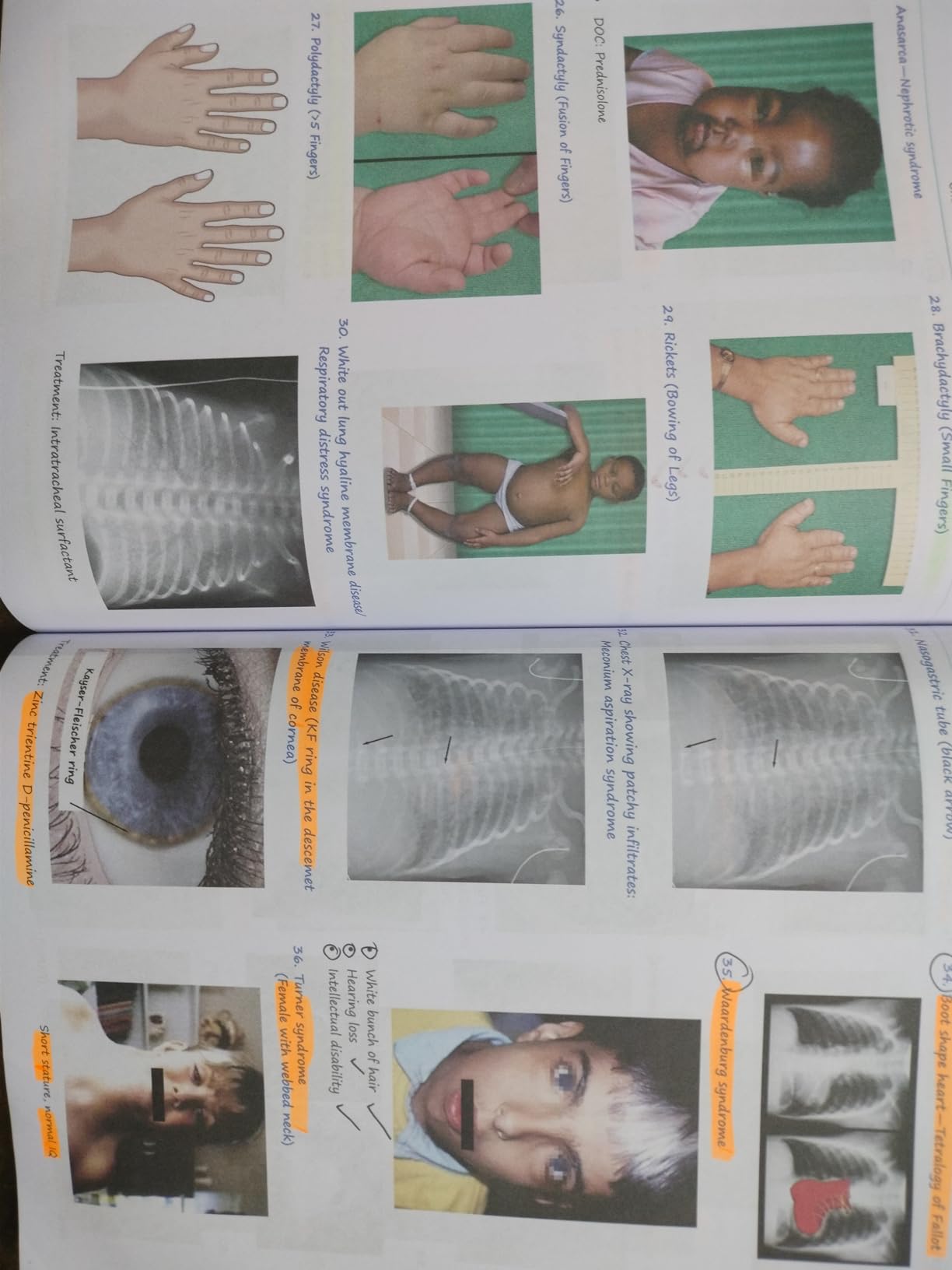 Buy ONE TOUCH Pediatrics for NEET/NEXT/FMGE/INI-CET (PB-2024) Book Online at Low Prices in India ...