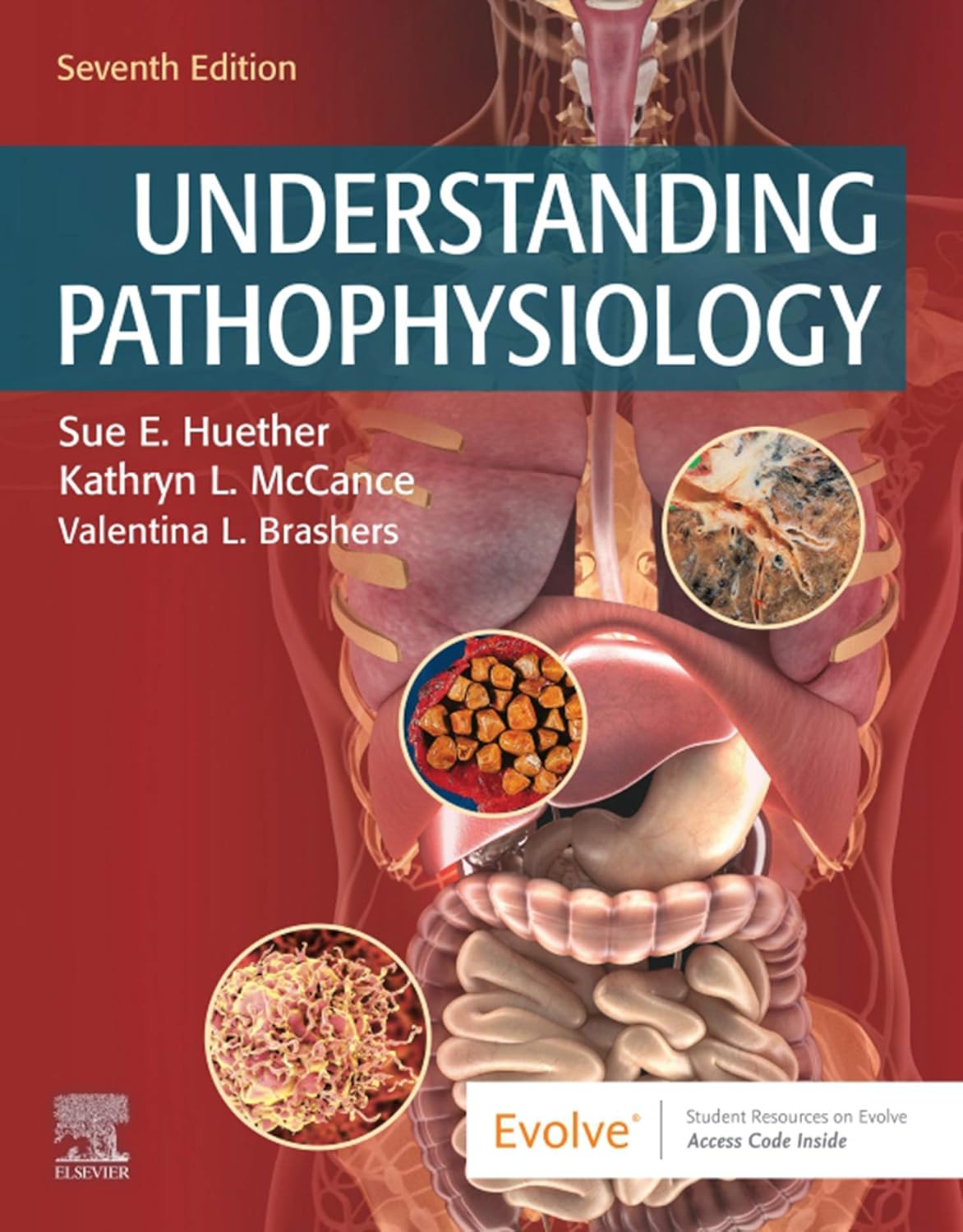Amazon.com: Understanding Pathophysiology - E-Book eBook : Huether MS ...