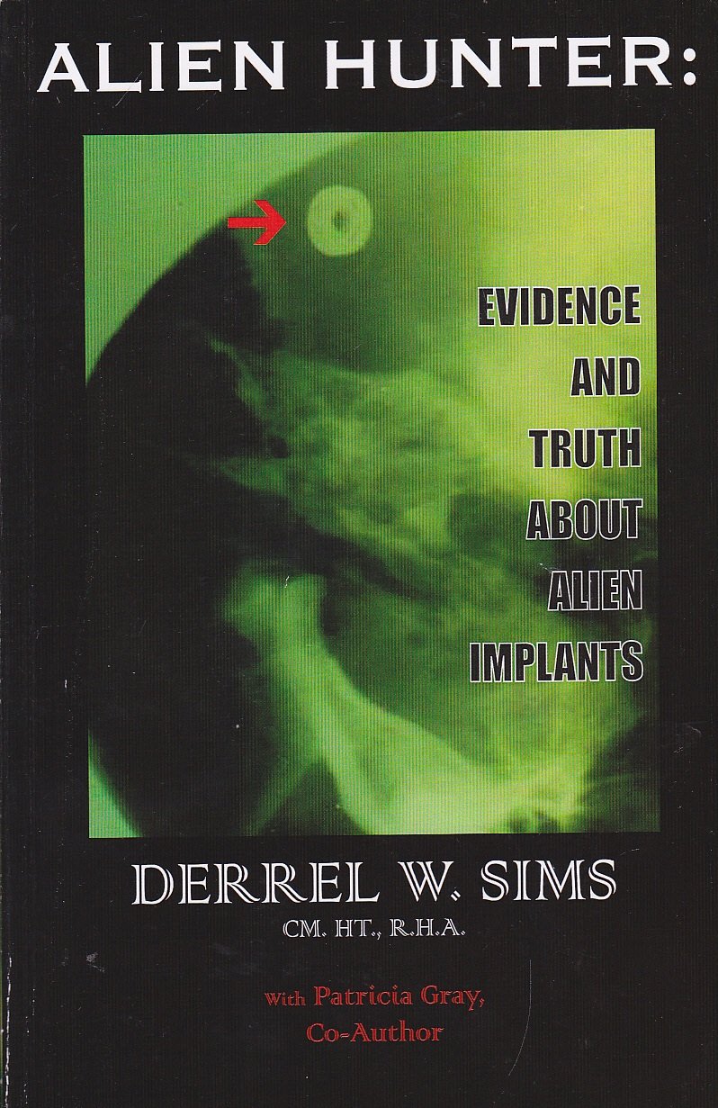 Alien Hunter: Evidence and Truth About Alien Implants: Sims, Derrel W ...