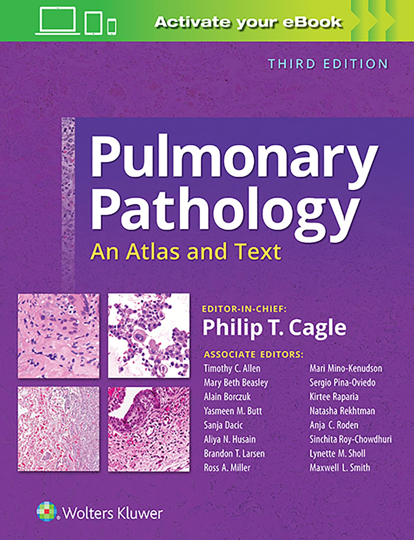 Pulmonary Pathology: An Atlas and Text: 9781496346094: Medicine ...