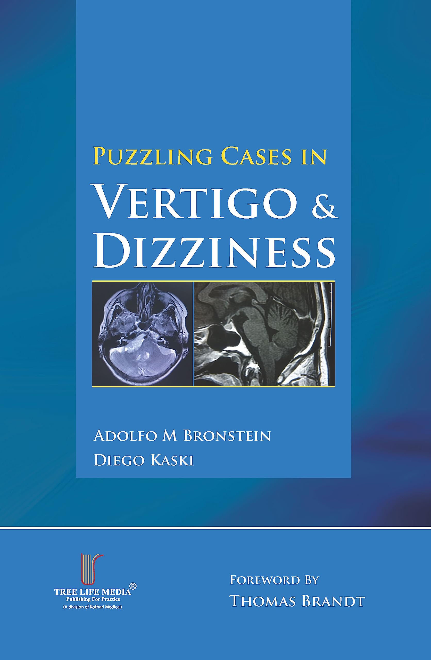 Buy Puzzling Cases in Vertigo & Dizziness Book Online at Low Prices in ...