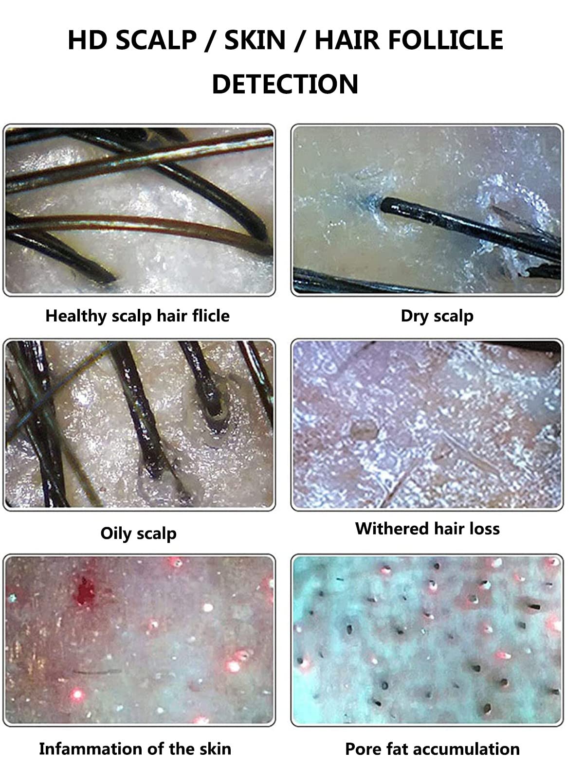 Hair Root Microscope