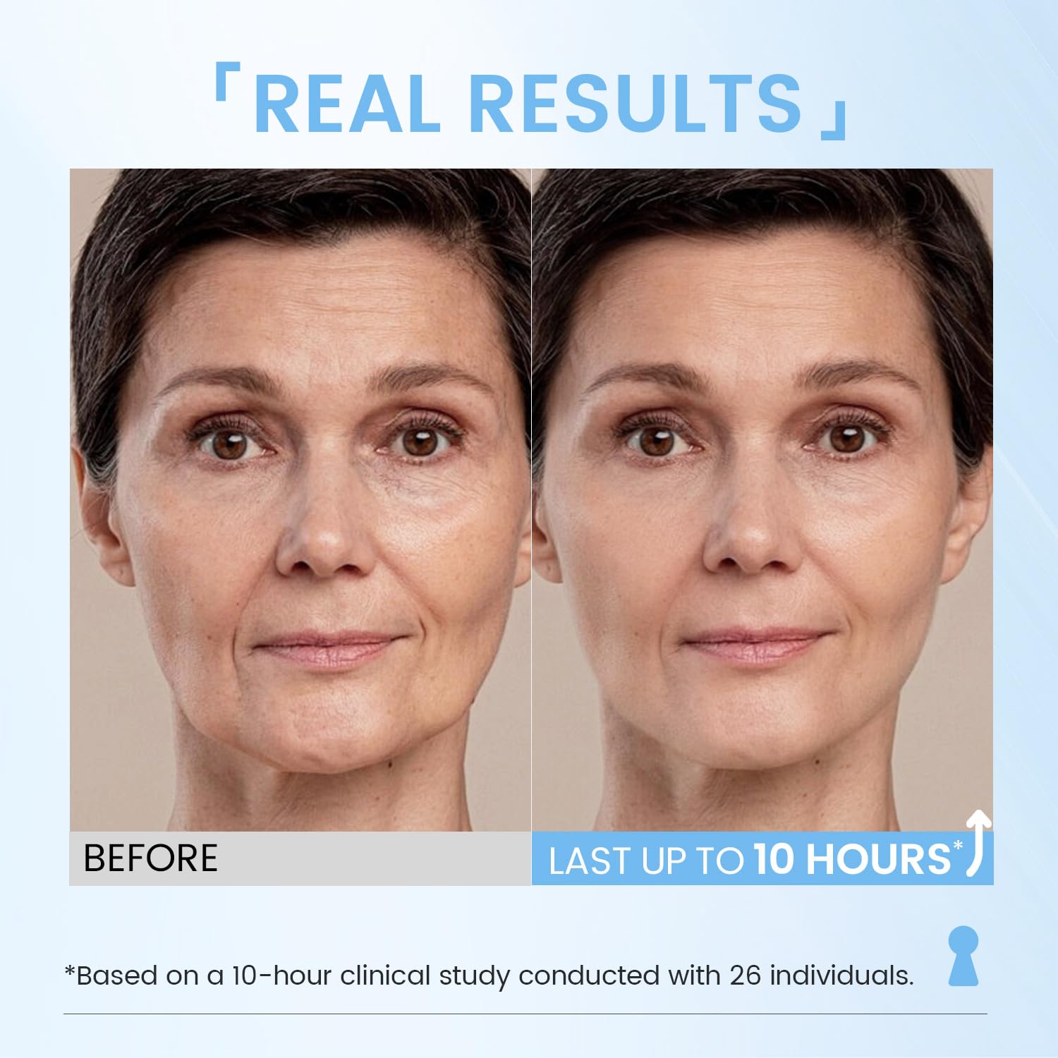 Snapklik.com : Instant Eye Lift Cream: Reduces Eye Bags Wrinkles Puffy ...