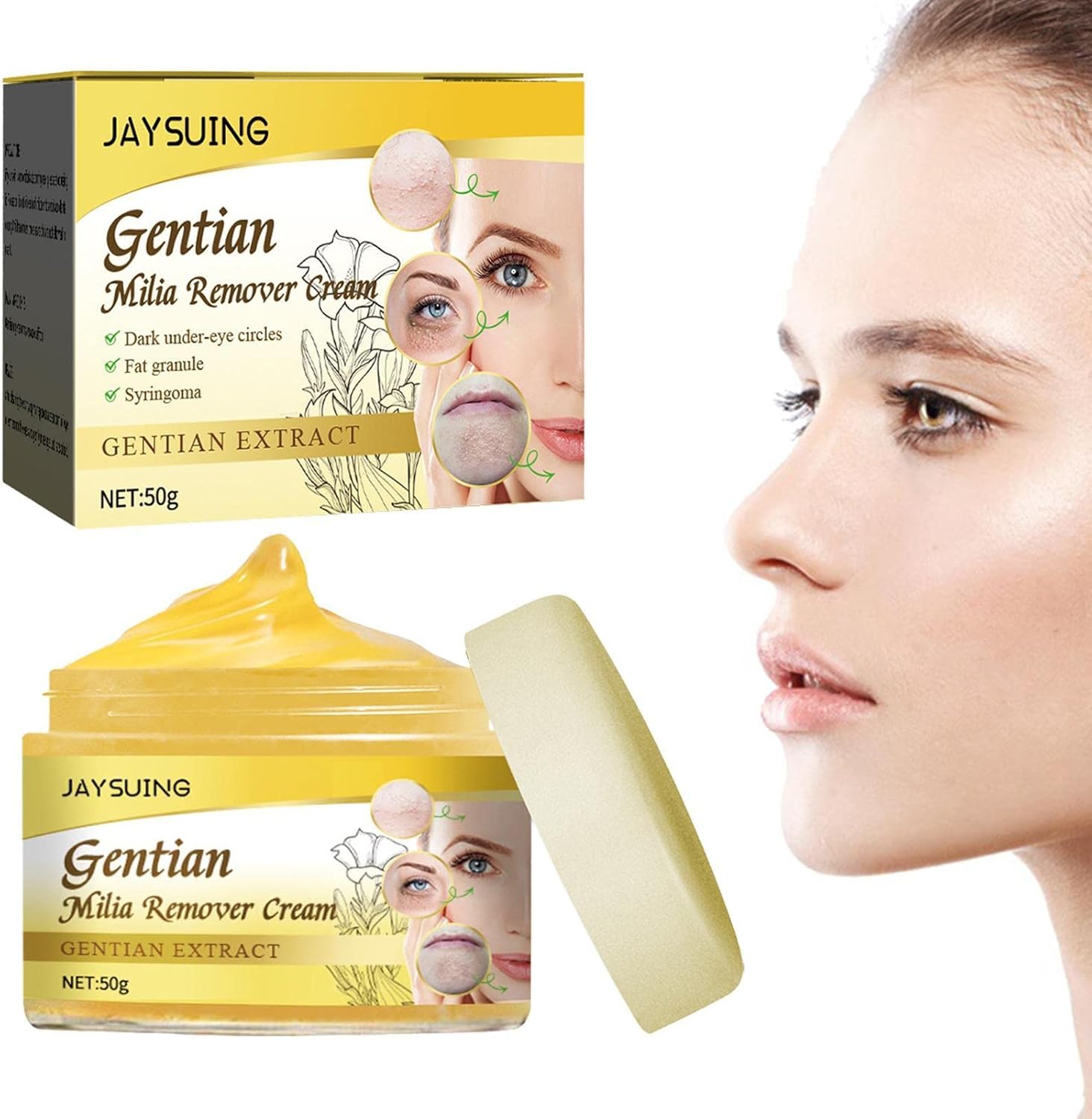 Eye Milia Removal Cream - Safe Eyes Dark Corrector for Girls,Skin ...