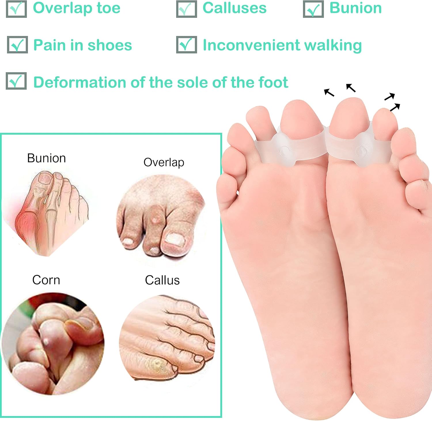 DYKOOK Bunion Gel Toe Separator Toe Separators with 2 Loops 10 Pack ...