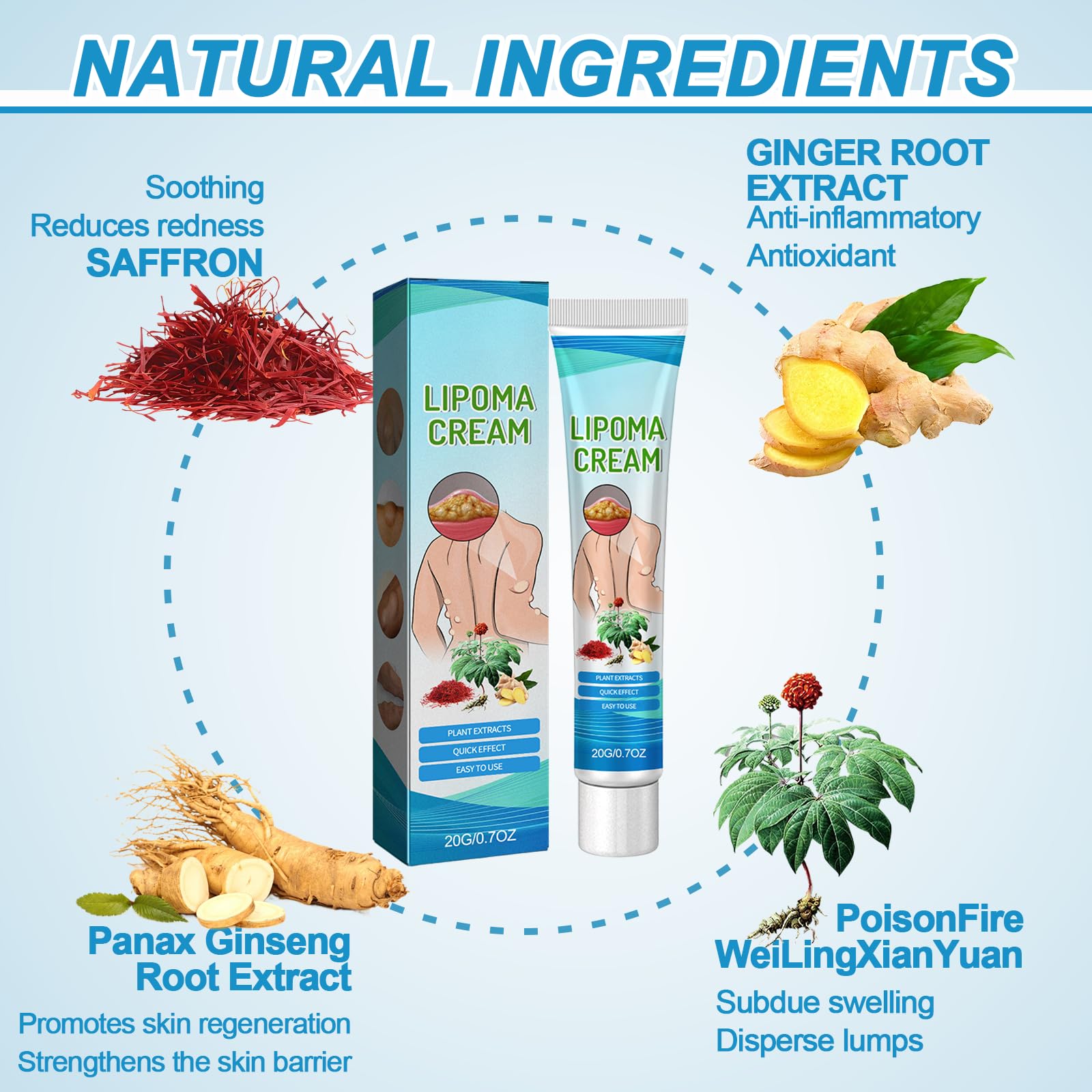 Lipoma Removal Cream, Herbal Lipoma Treatment Cream Natural Formula ...