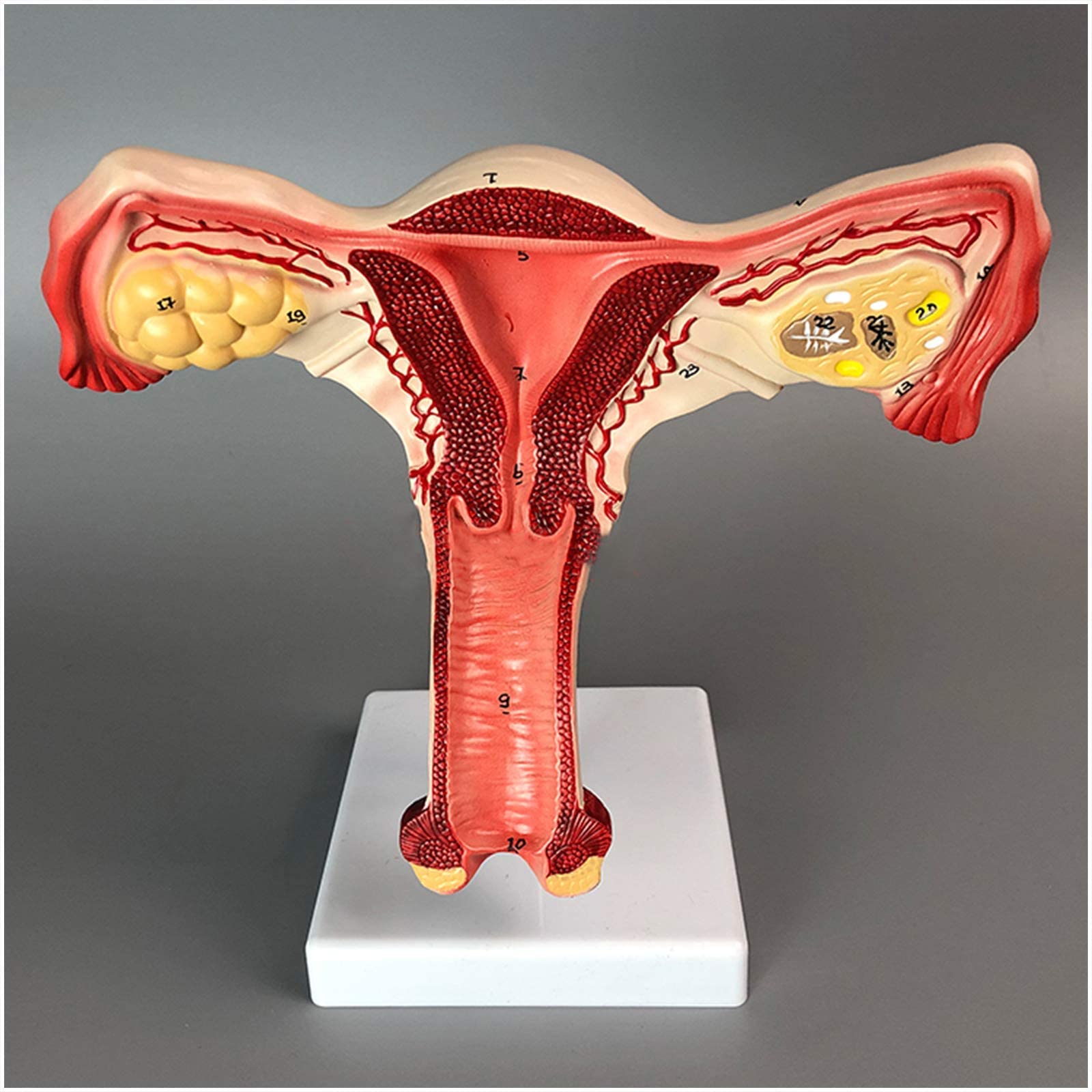 Utero Normal De Verdade Utero Normale YouTube