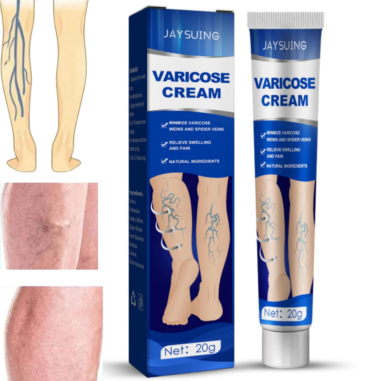 Buy Varicose Veins Cream,Varicose Veins for Leg,Spider Vein Cream ,Vein ...