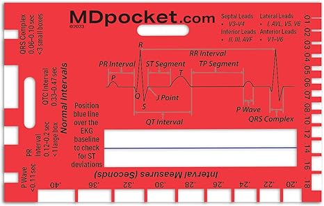 Amazon.com: Rapid ID - EKG Intervals and Infarctions with Clear Window ...