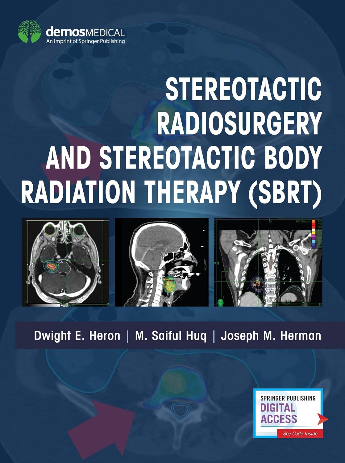 Stereotactic Radiosurgery and Stereotactic Body Radiation Therapy (SBRT ...