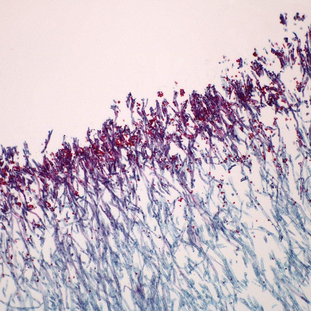Penicillium Microscope Penicillium Italicum P Roqueforti Fungi