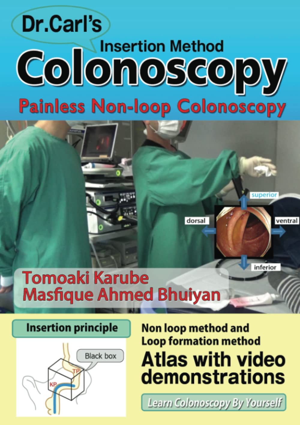 Amazon.co.jp: Dr. Carl's Colonoscopy insertion method: Painless Non-loop Colonoscopy : Karube ...