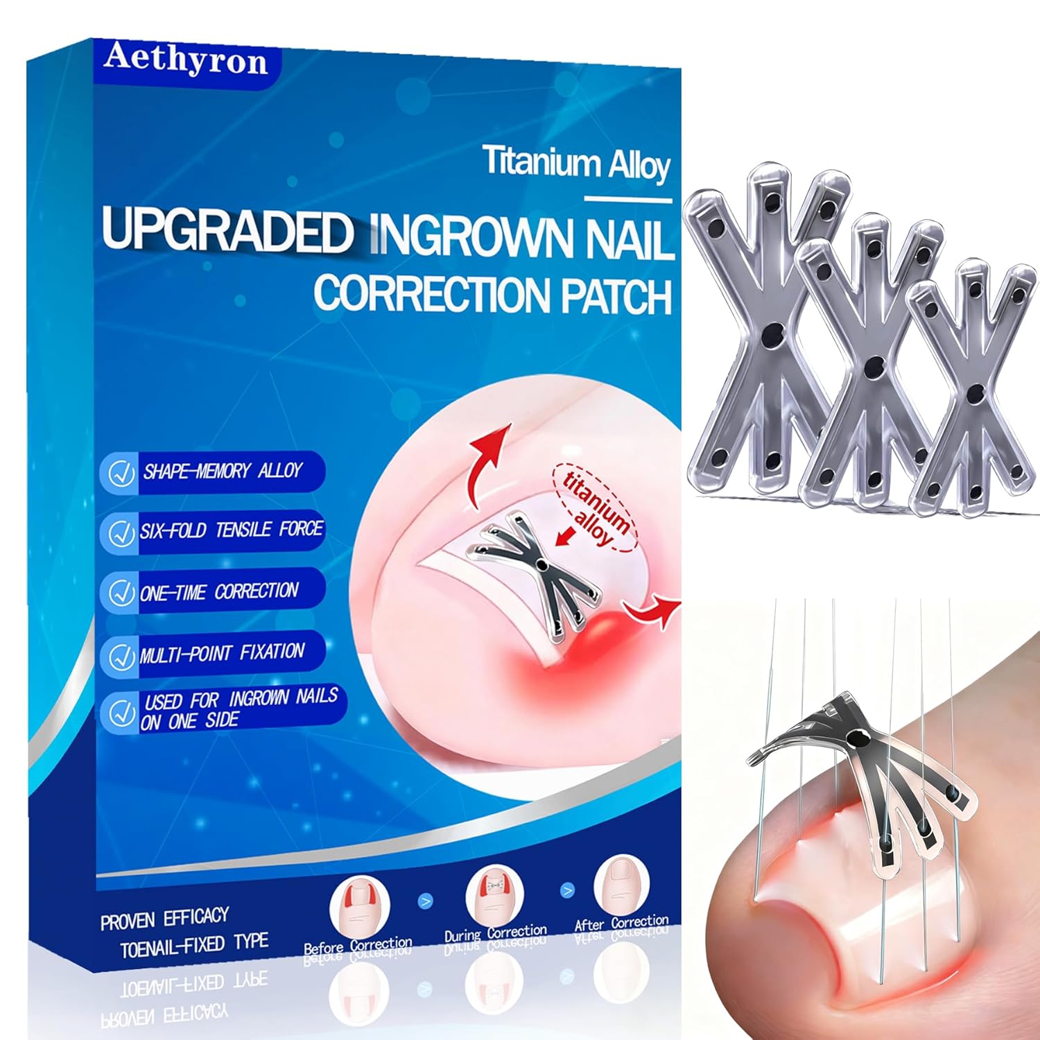 Amazon.com: Ingrown Toenail Treatment with Upgraded 6-Angle Shape ...