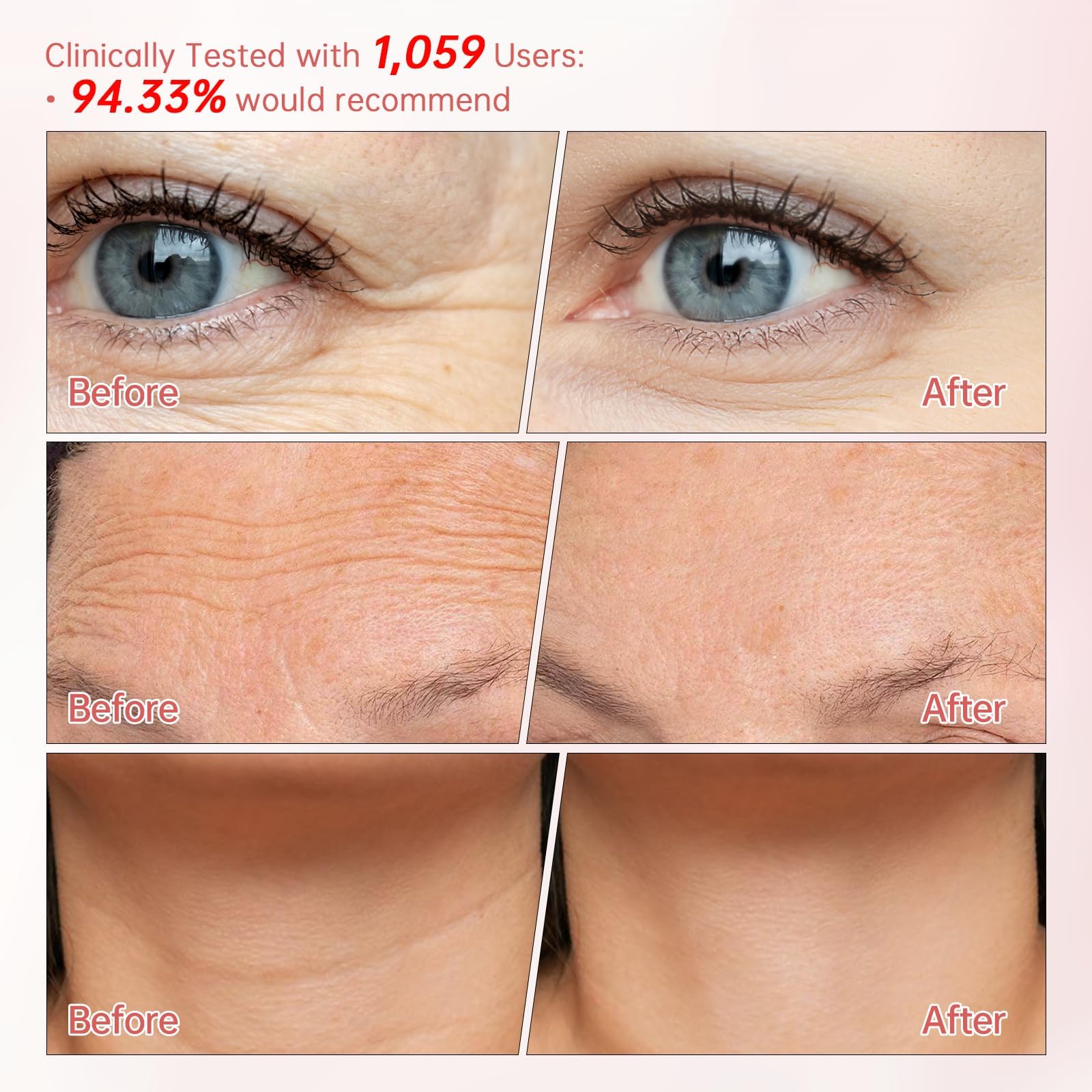 Snapklik.com : Peunitory Eye Balm Stick,Under Eye Cream Anti-Wrinkle ...