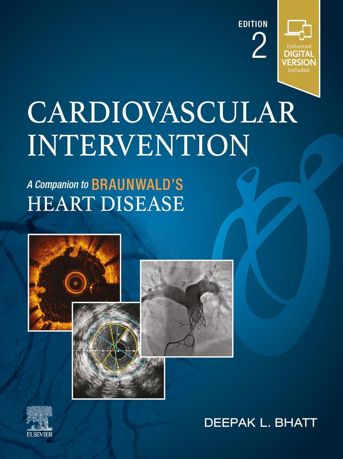 Amazon.co.jp: Cardiovascular Intervention: A Companion to Braunwald’s Heart Disease (Companion ...
