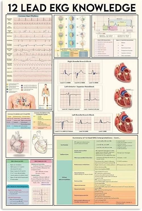 Amazon.com: Youpinnong Medical Poster Wall Art Decor 12 Lead Ecg ...