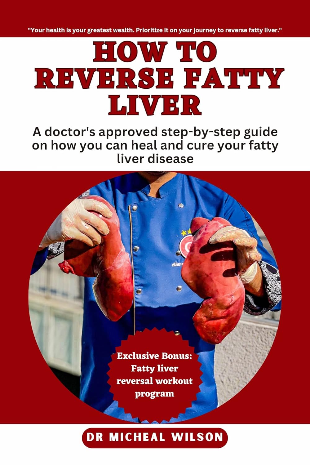 How to reverse fatty liver: A doctor's approved step-by-step guide on ...