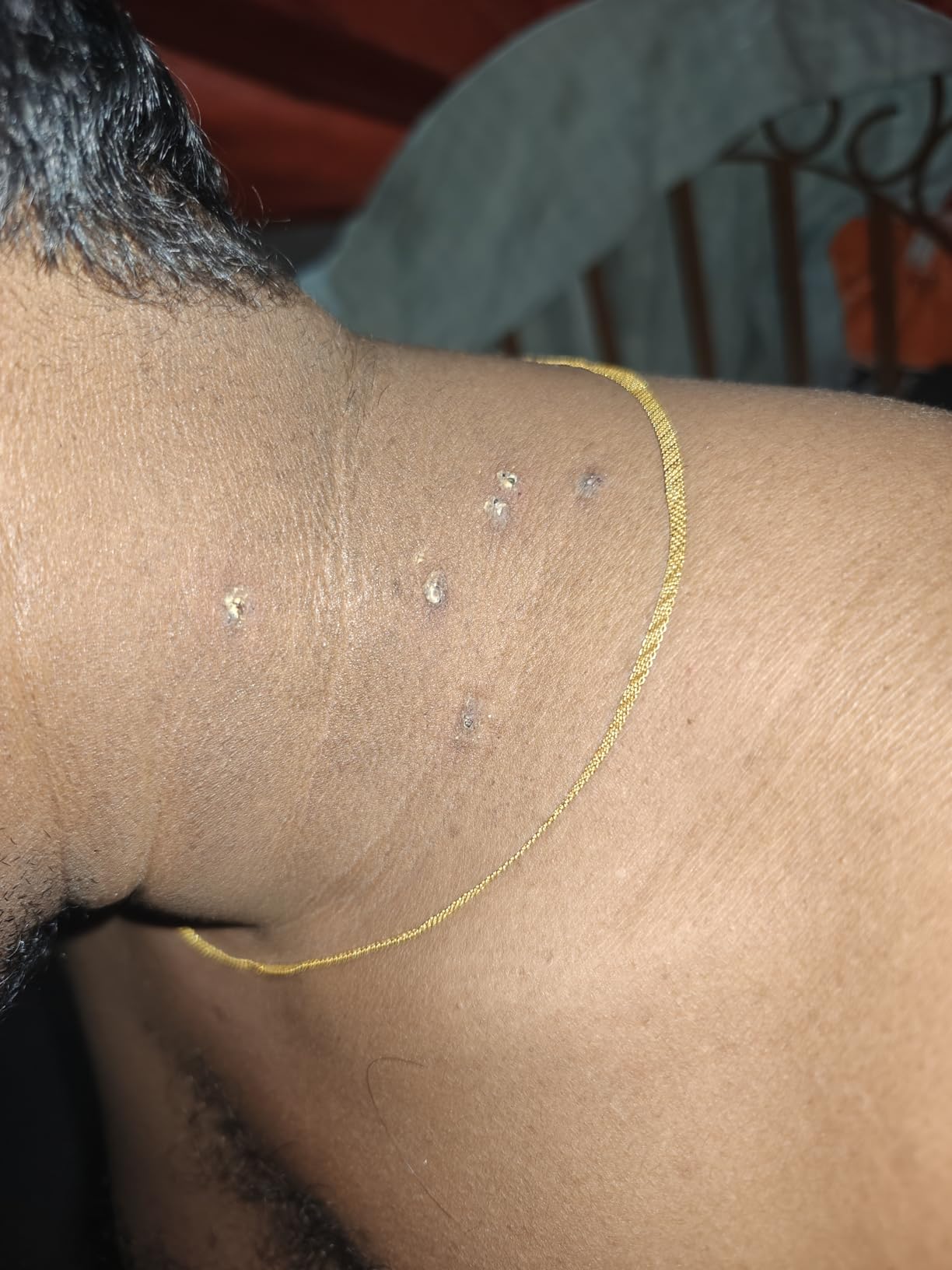 Buy Vemana Pulipiri Wart Remover 10 Grams Online at Low Prices in India ...