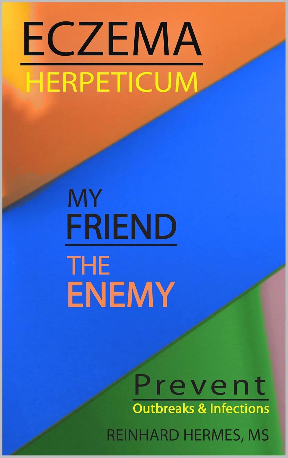 Amazon.com: Eczema Herpeticum: My Friend, the Enemy eBook : Hermes ...