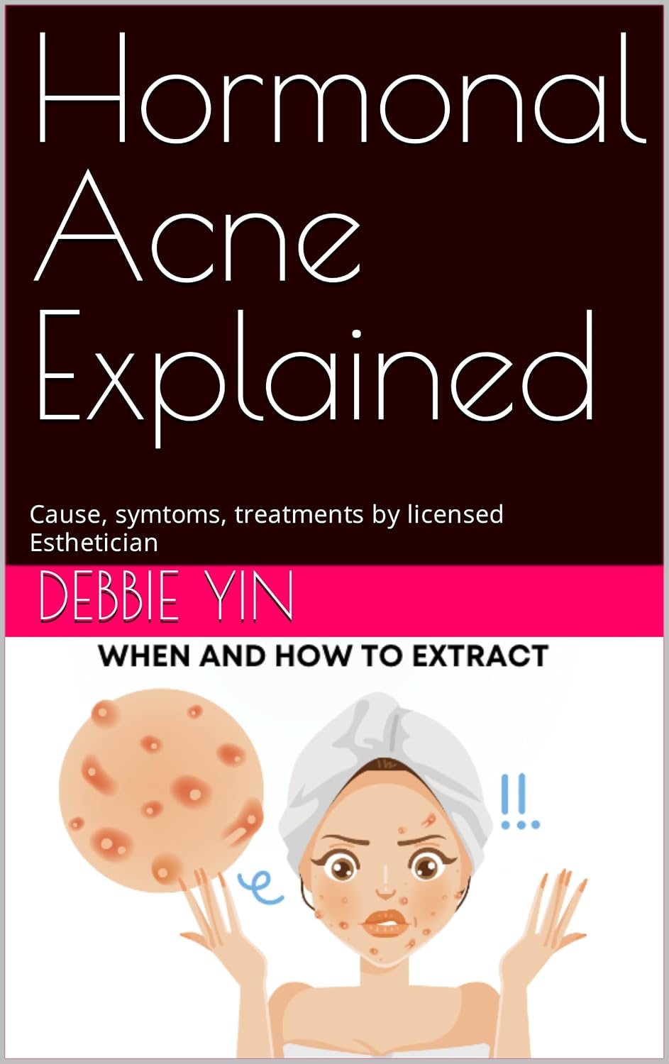 Amazon.com: Hormonal Acne Explained: Cause, symtoms, treatments by ...