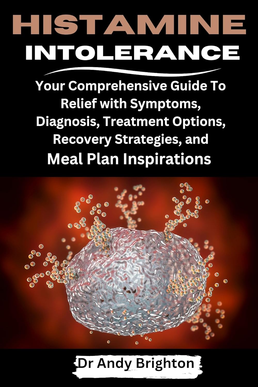 Amazon.com: HISTAMINE INTOLERANCE: Your Comprehensive Guide To Relief ...