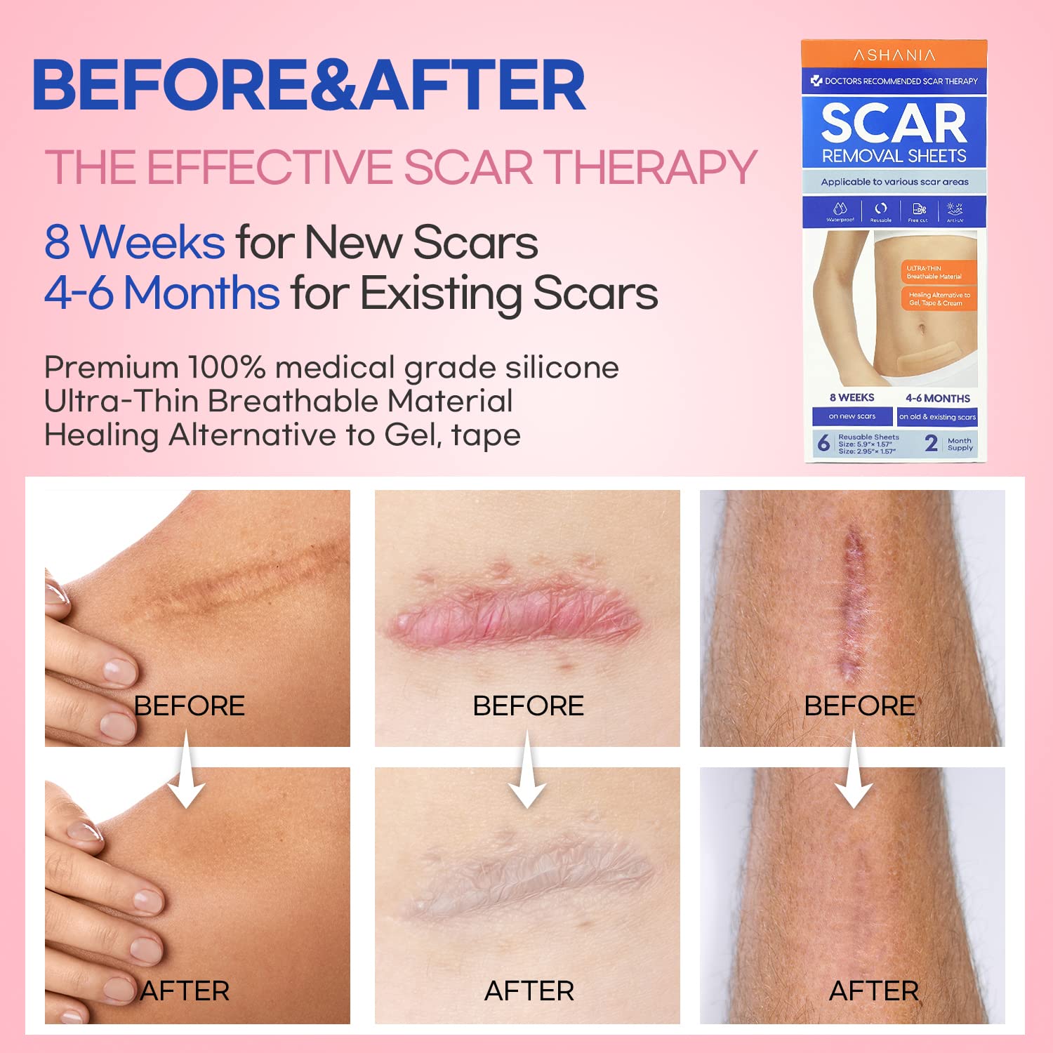 Snapklik.com : 2 Sizes Sheet Silicone Scar Removal Sheets For Diverse ...