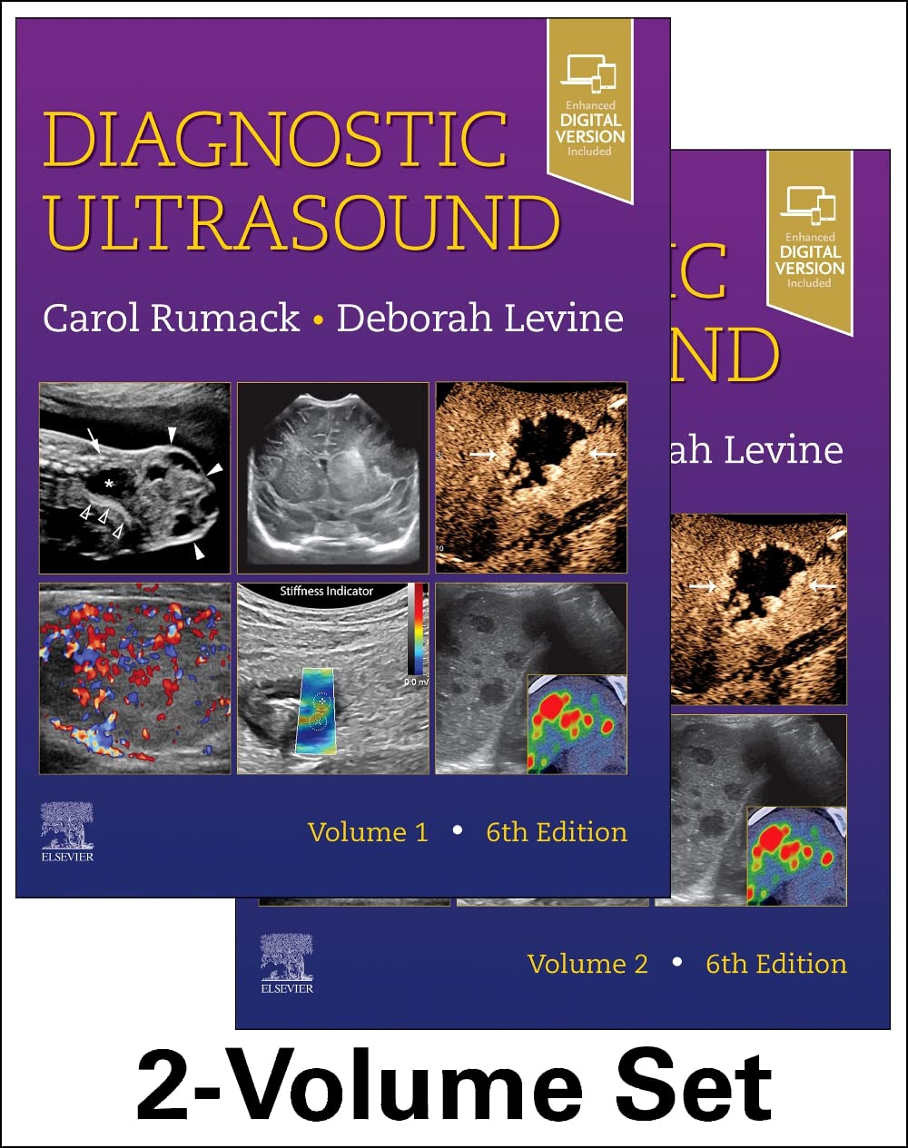 Diagnostic Ultrasound, 2-Volume Set: 9780323877954: Medicine & Health ...