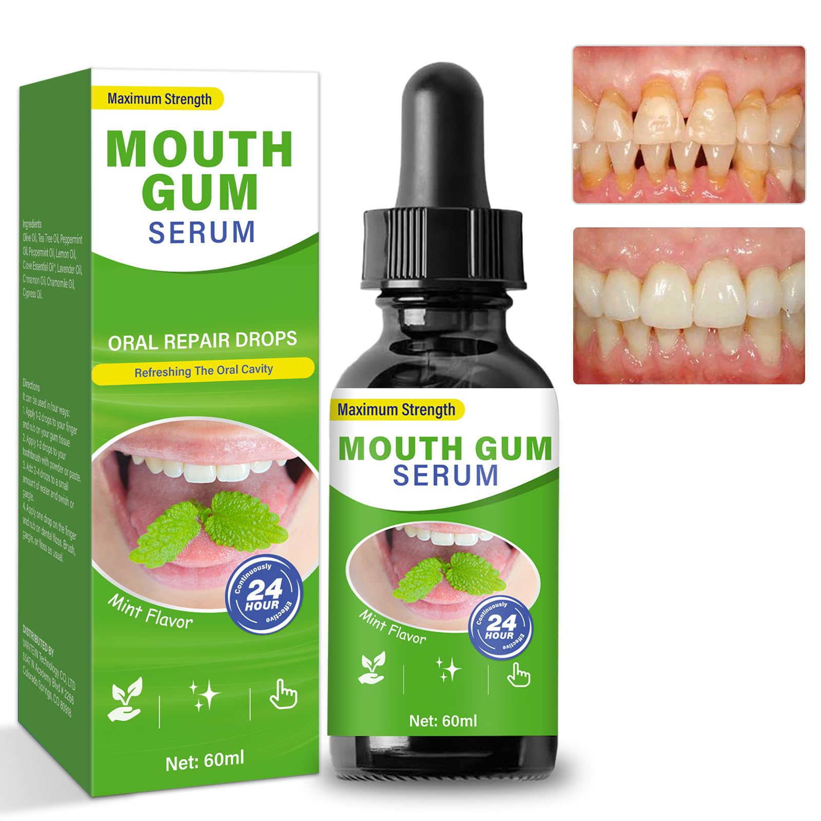 Buy Mouth Gum Restore Drops, Dirty Mouth Gum Serum for Gum Regrowth ...