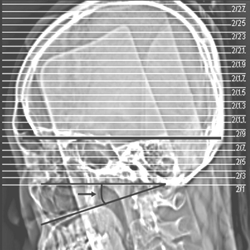 CT POSITIONING - App on Amazon Appstore
