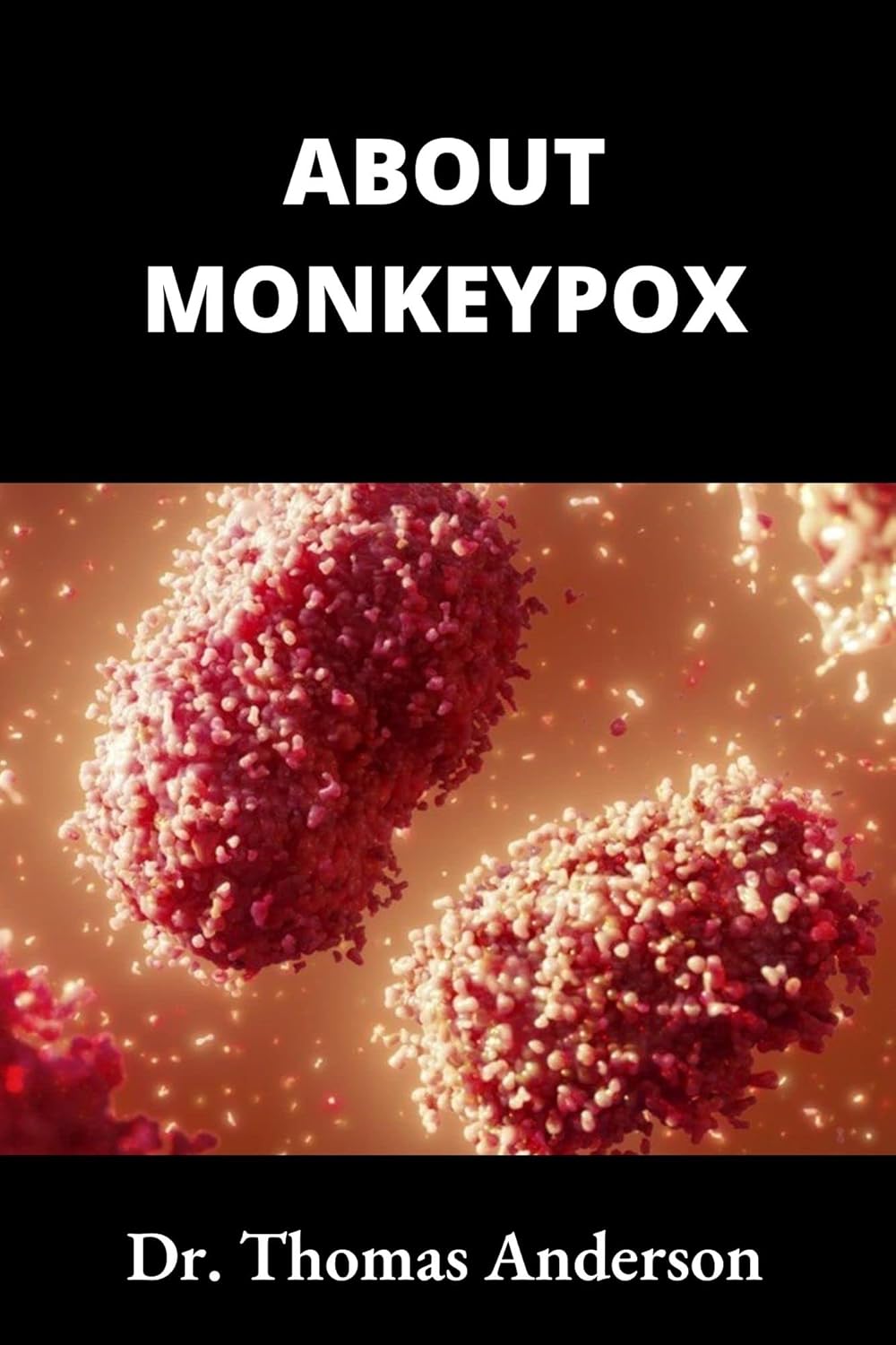 Amazon.com: About Monkeypox: Everything You Need To Know About ...