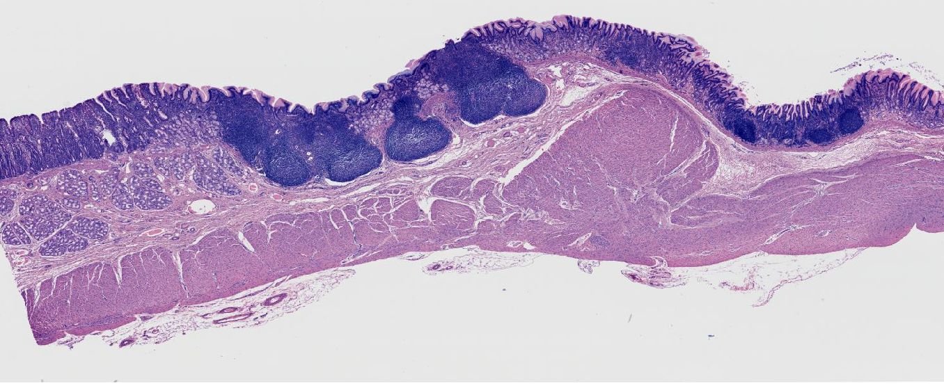 Duodenum Slide