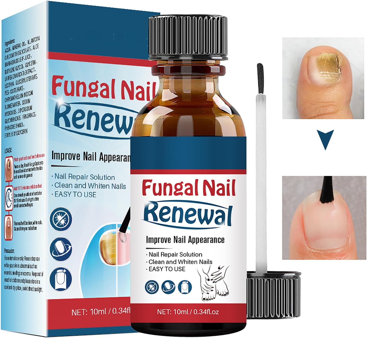 Amazon.com : Easilydays Nail Repair Essnce Liquid, Fingernail and ...